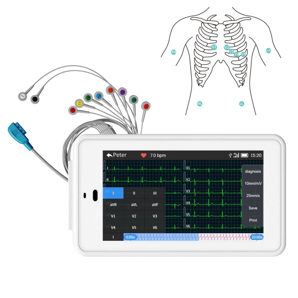 Point-of-Care 12-Lead ECG/EKG Machine Based on A Tablet, with Auto Interpretation & Analysis ...